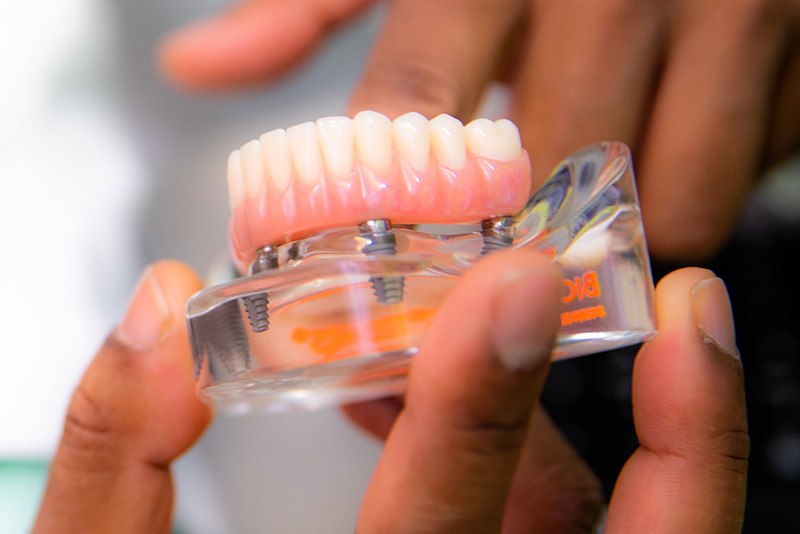 Fixed Vs. Removable Teeth | Melbourne, FL | Wickham Dental Care ...